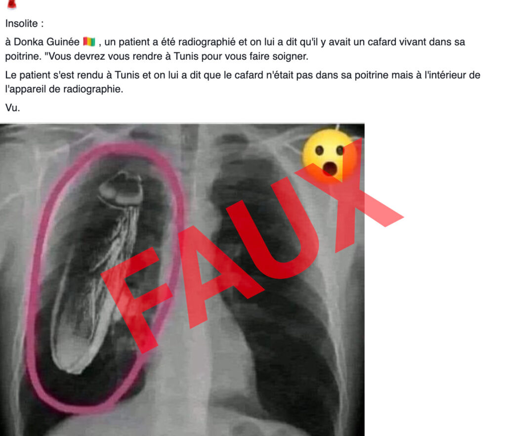Faux: aucun cafard ‘’vivant’’ n’a été trouvé dans la poitrine d’un ...